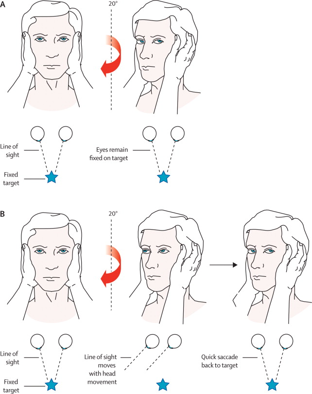 포바즈 온라인 서비스 > 4BAZ 컬럼 > Head thrust 검사 for Mobile