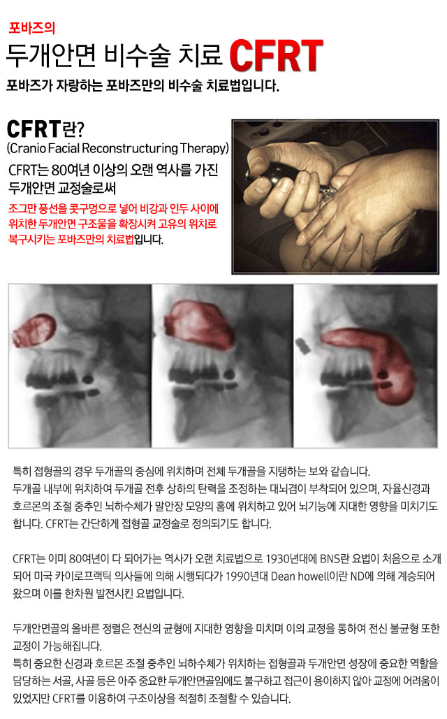 포바즈 두개안면교정 (CFRT : Cranio Facial Reconstructuring Therapy) 소개 : 포바즈 치료법 ...