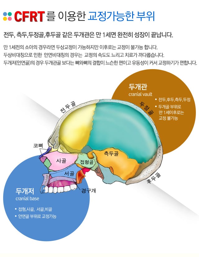 포바즈 두개안면교정 (CFRT : Cranio Facial Reconstructuring Therapy) 소개 : 포바즈 치료법 ...