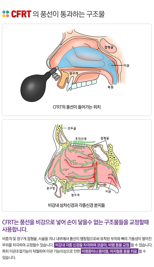 포바즈 두개안면교정 (CFRT : Cranio Facial Reconstructuring Therapy) 소개 : 포바즈 치료법 ...