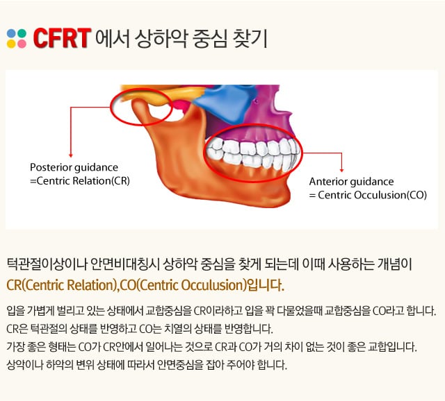 포바즈 두개안면교정 (CFRT : Cranio Facial Reconstructuring Therapy) 소개 : 포바즈 치료법 ...